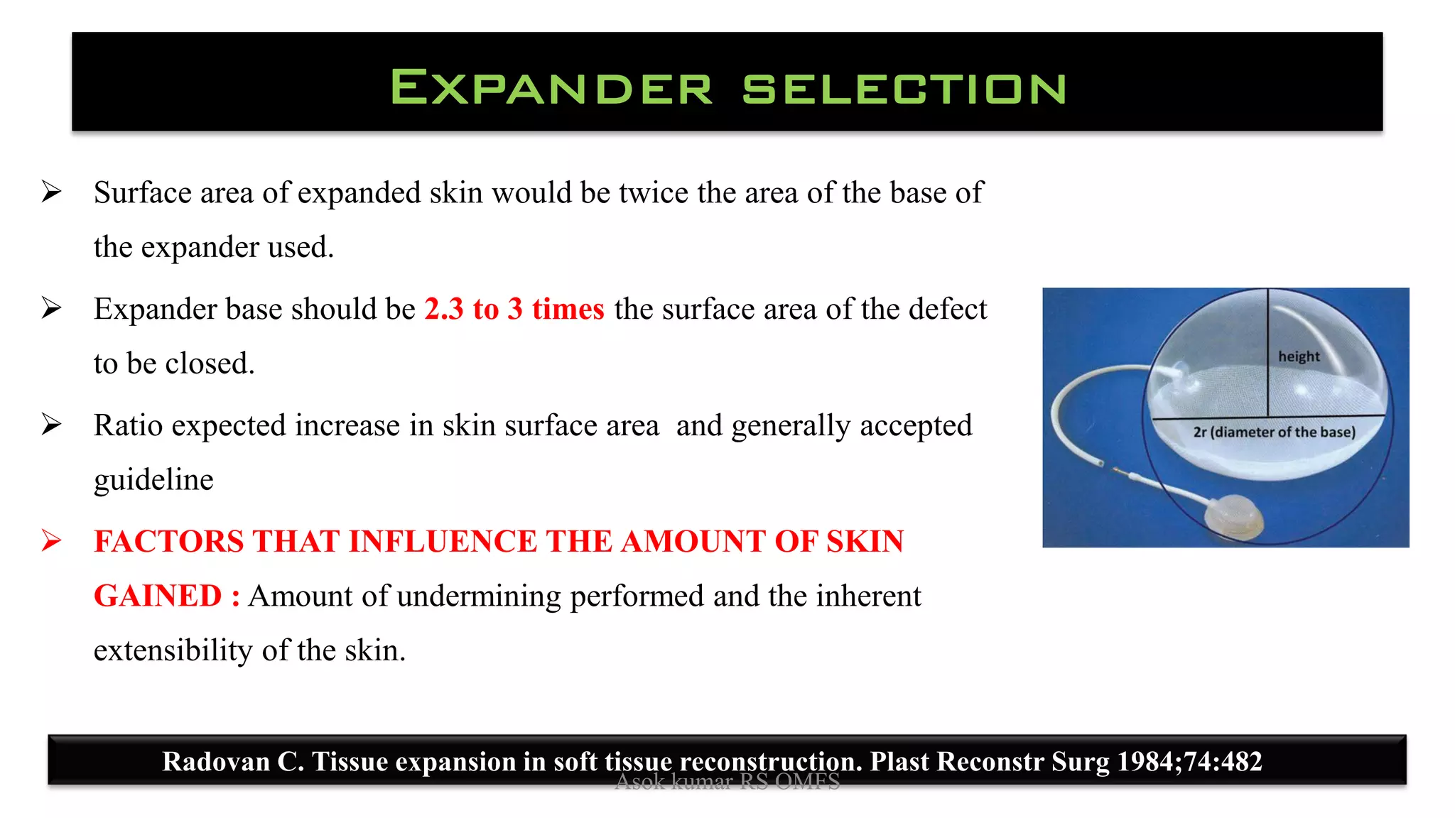 Tissue expander in omfs | PDF