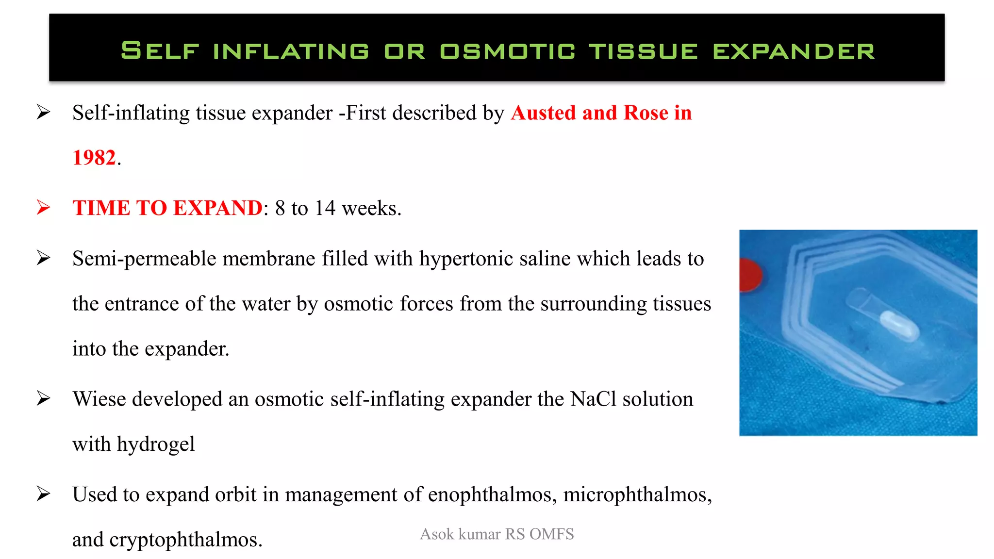 Tissue expander in omfs | PDF