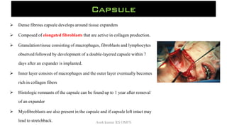 Tissue expander in omfs | PDF