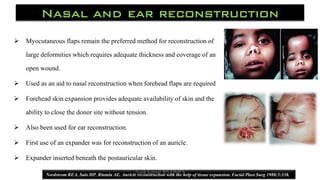 Tissue expander in omfs | PDF