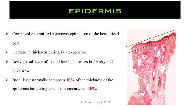Tissue expander in omfs | PDF | Skin and Dermatology | Diseases and ...
