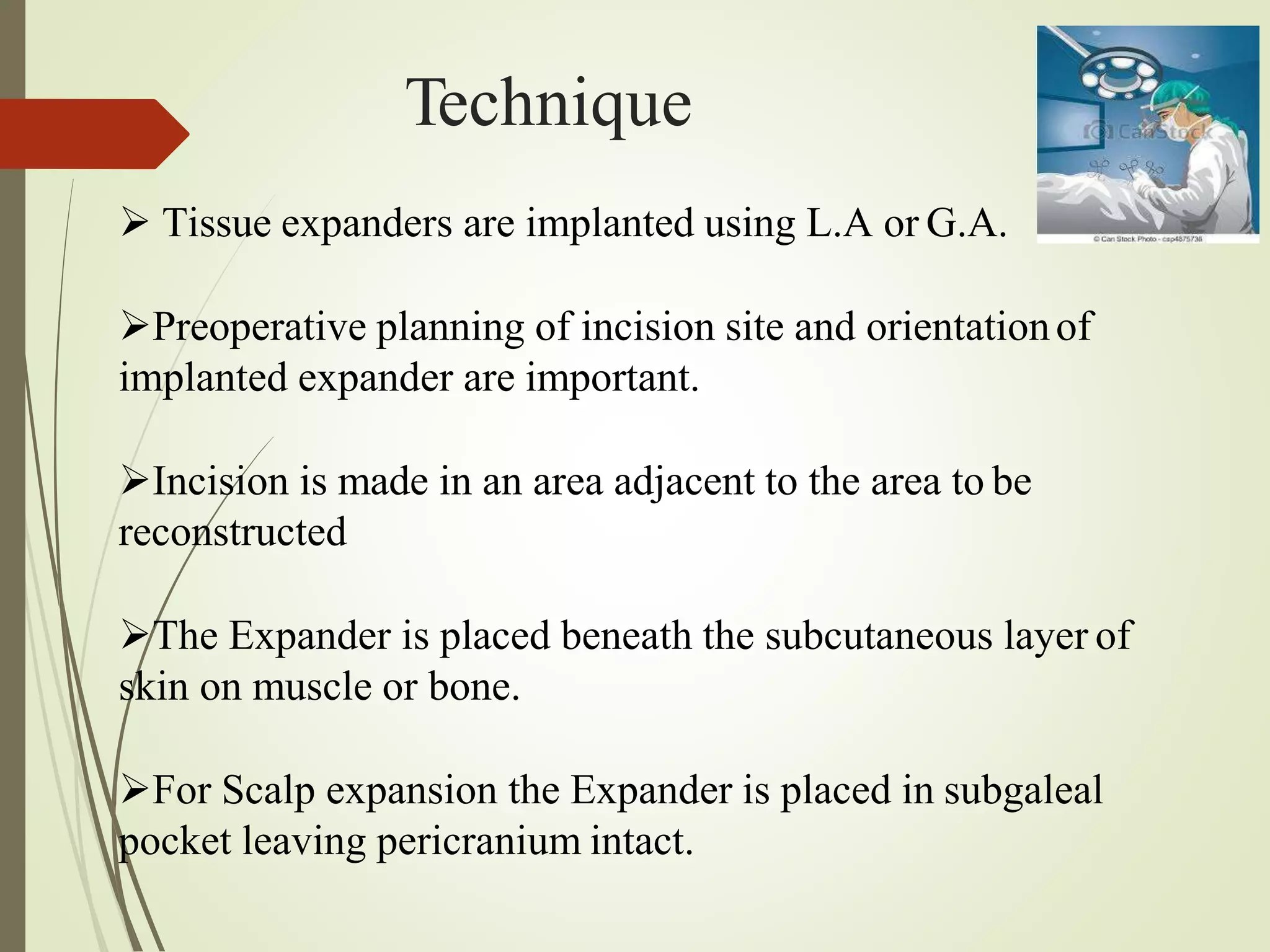 Tissue expanders in oral and maxillofacial surgery | PPTX