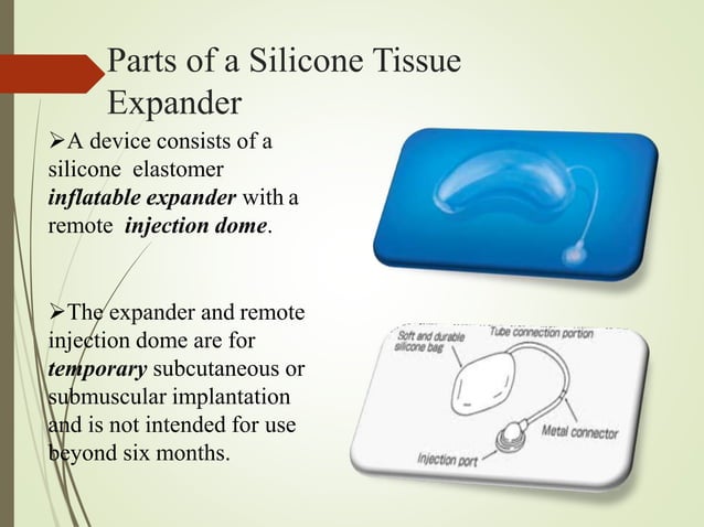 Tissue expanders in oral and maxillofacial surgery | PPTX | Skin and ...