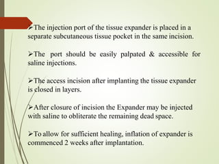 Tissue expanders in oral and maxillofacial surgery | PPTX