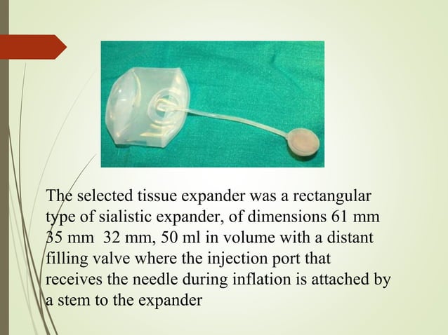 Tissue expanders in oral and maxillofacial surgery | PPTX | Skin and ...