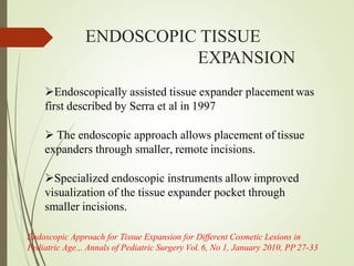 Tissue expanders in oral and maxillofacial surgery | PPTX