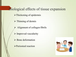 Tissue expanders in oral and maxillofacial surgery | PPTX