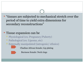 Tissue Expansion , a technique used in plastic surgery | PPTX