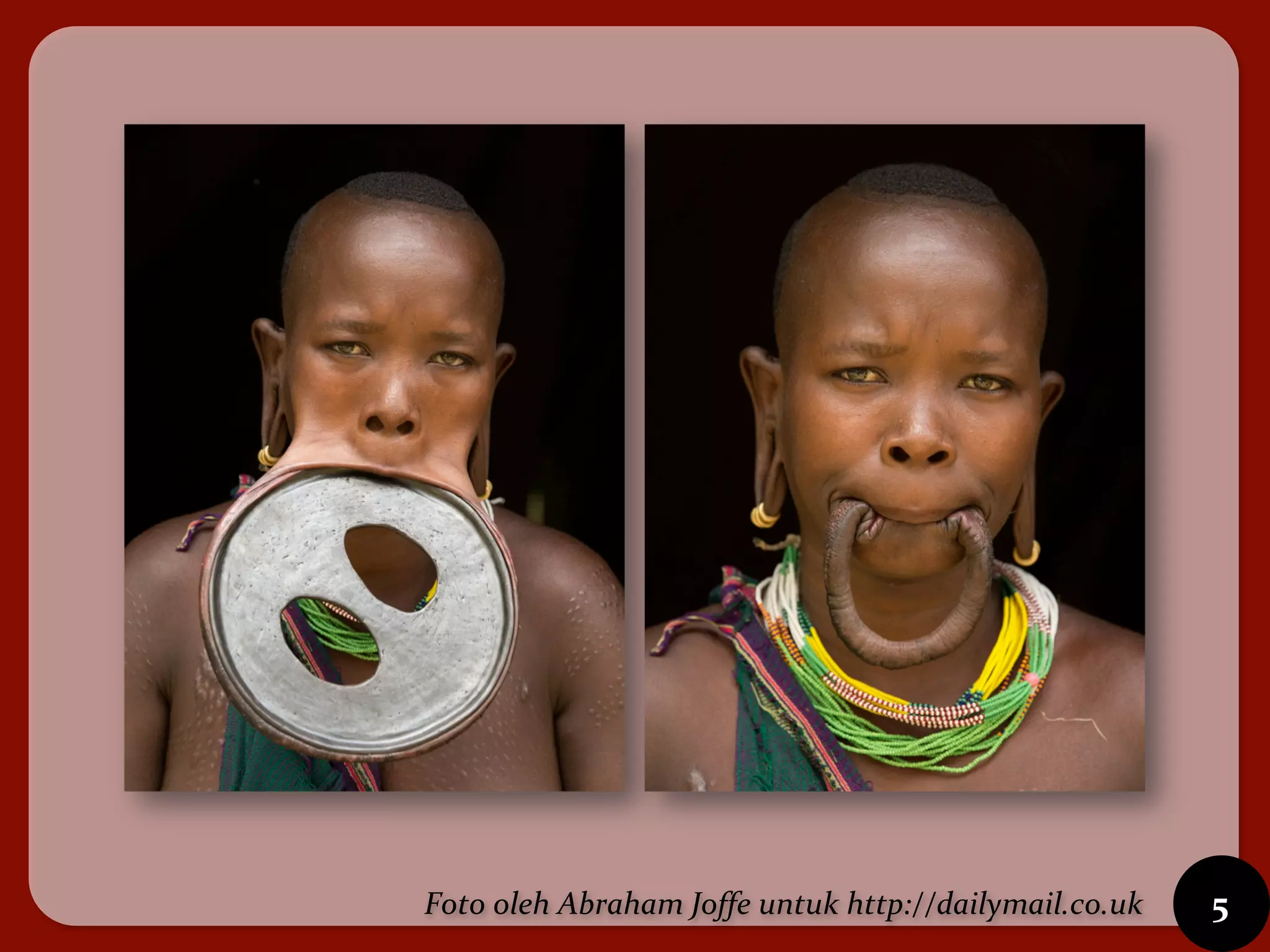 Tissue Expansion | PDF