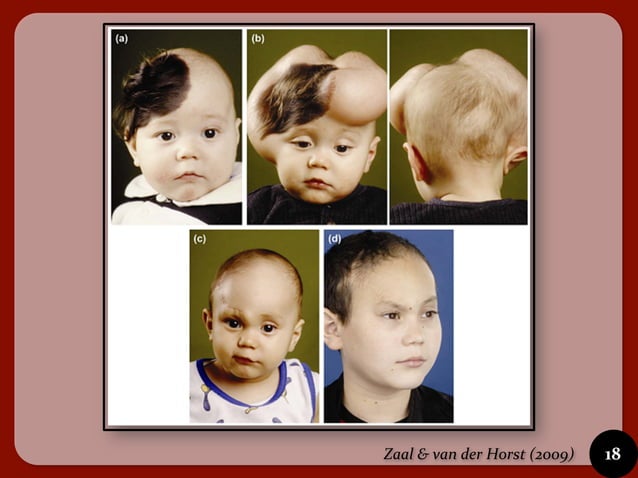 Tissue Expansion | PPT