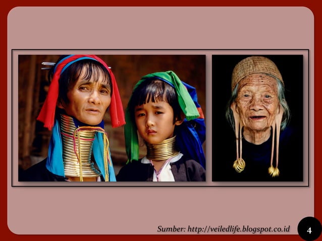 Tissue Expansion | PPT