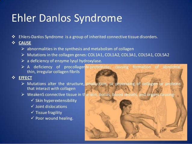 Collagen! - The connective Tissue Protein