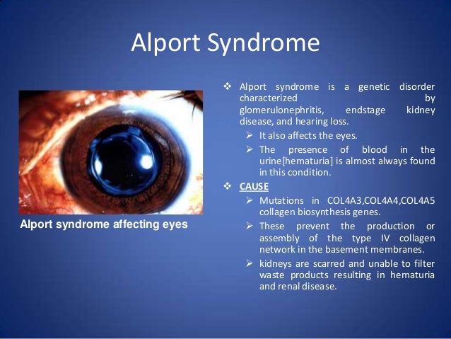 Collagen! - The connective Tissue Protein