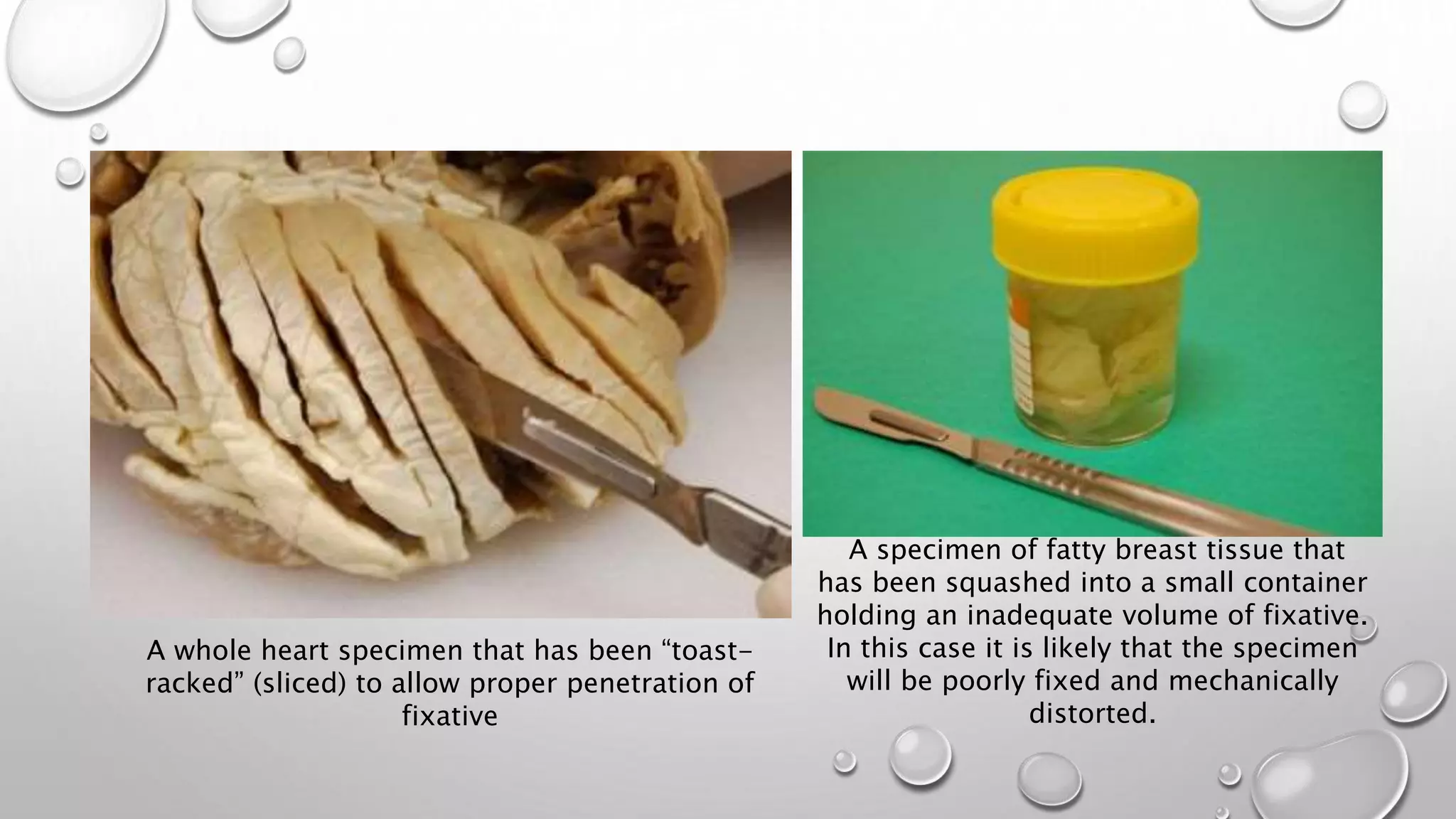 Tissue fixation | Histotechniques | abdul quddus | PPTX