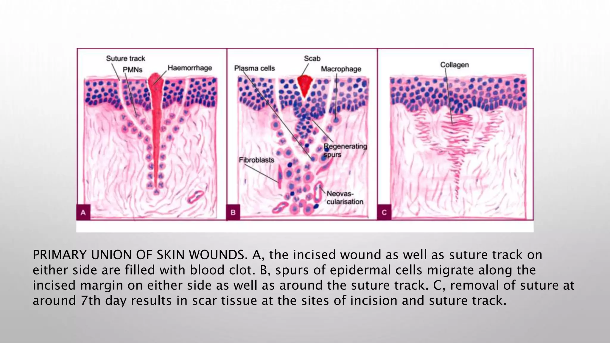 Tissue healing | PPTX