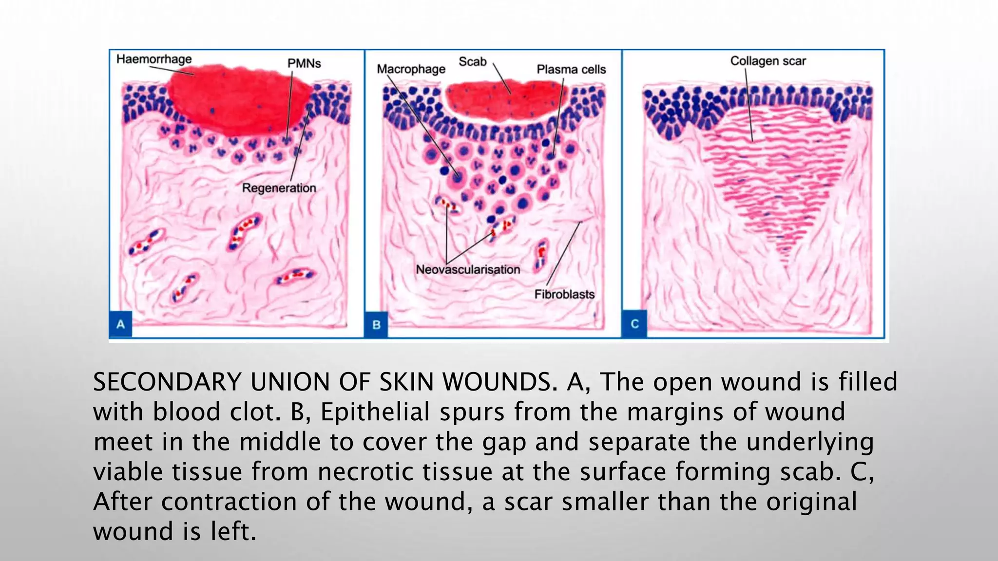 Tissue healing | PPTX