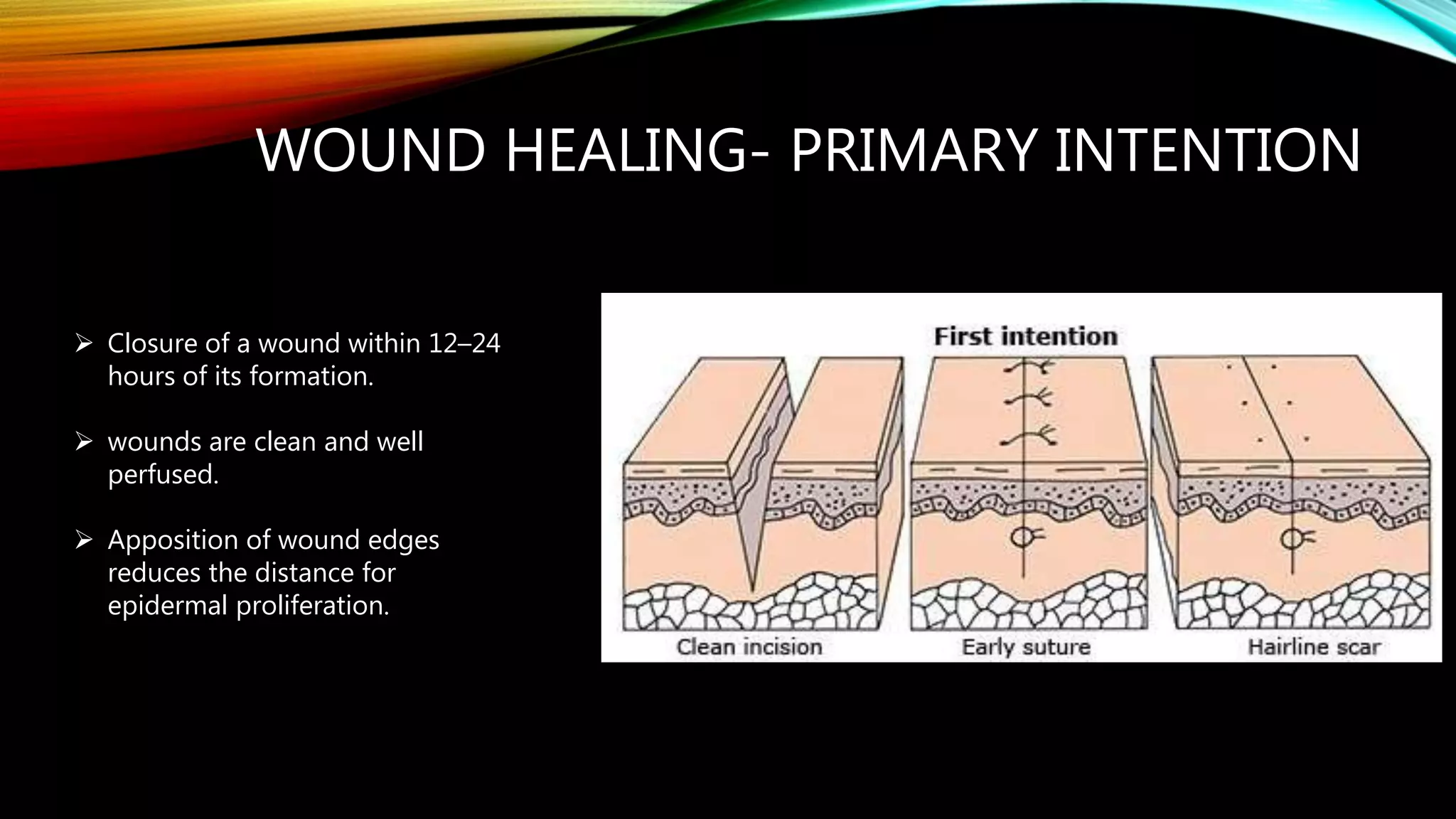 wound healing | PPTX