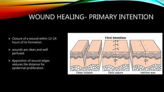 wound healing | PPTX