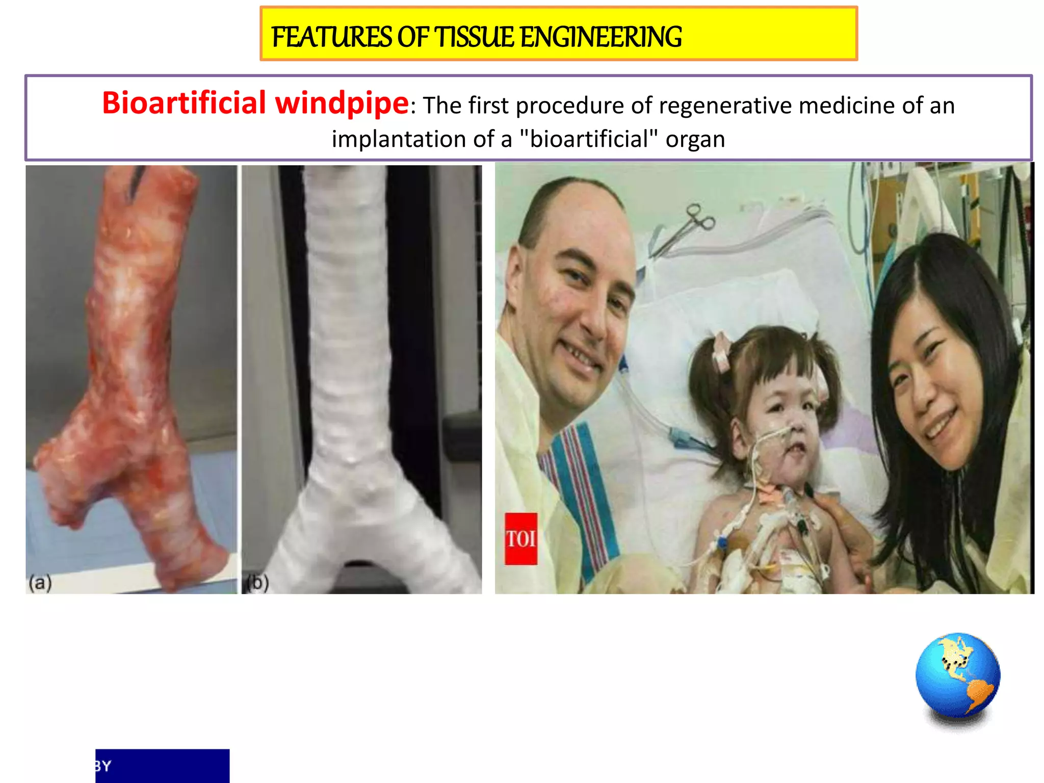 Tissue ingineering biot | PPT | Free Download