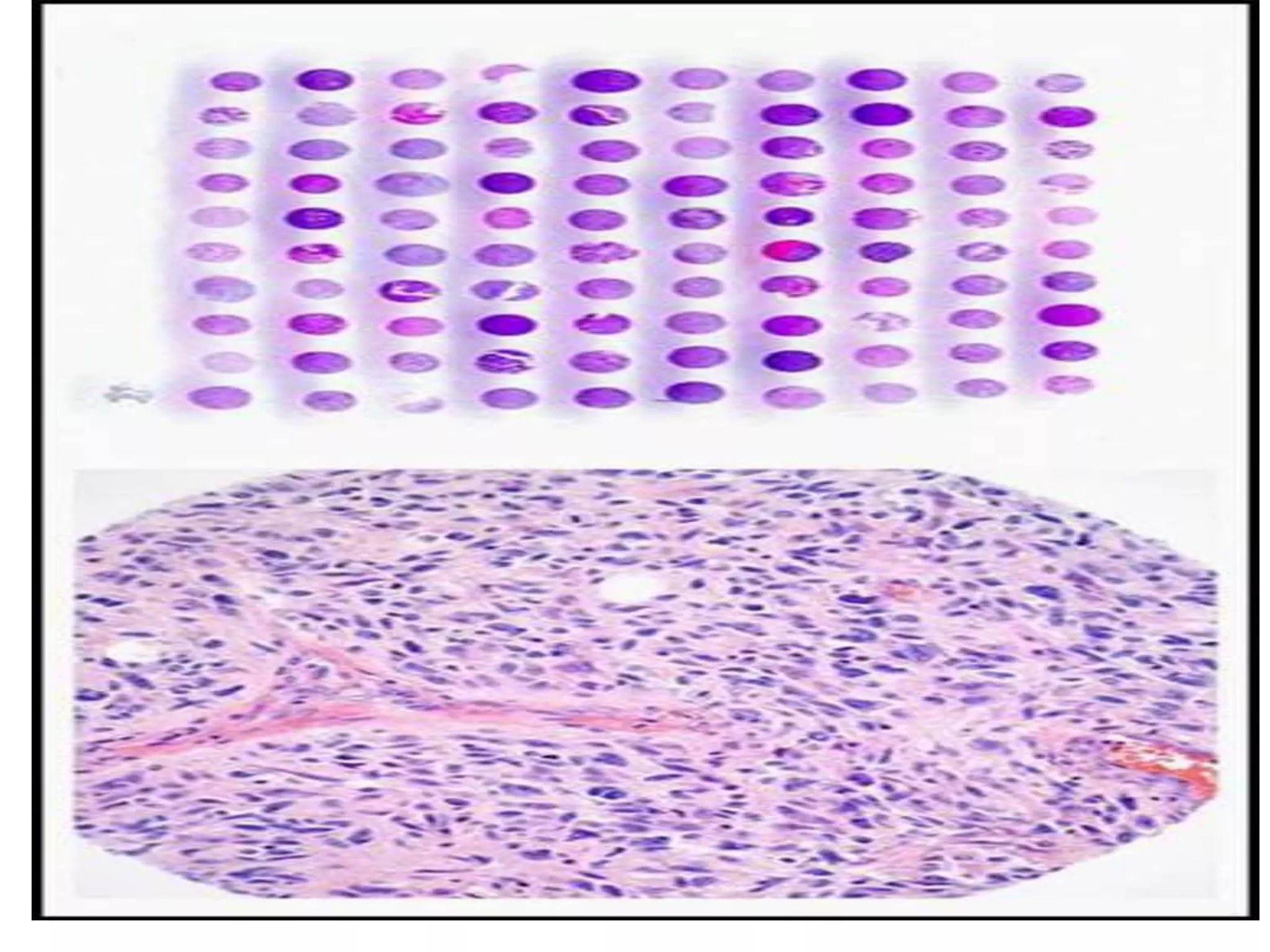 Tissue microarray | PPTX