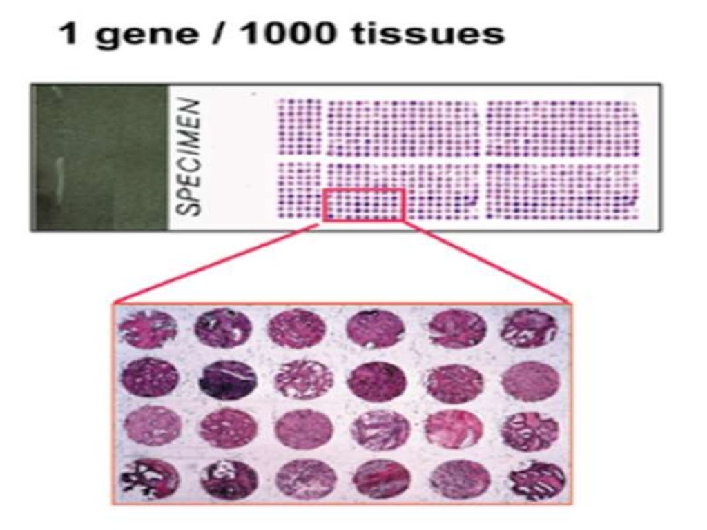 Tissue microarray