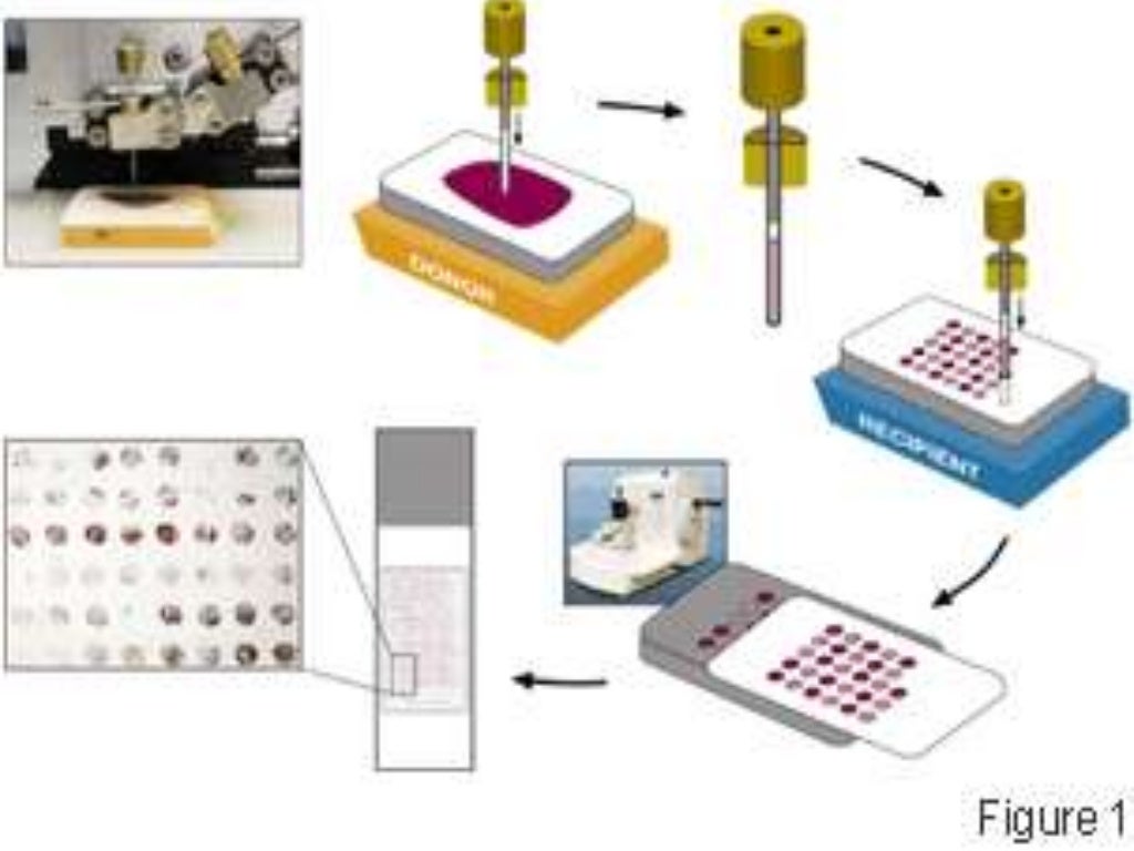 Tissue microarray