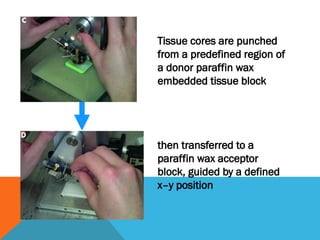 tissue microarray to study large no. of samples.pptx