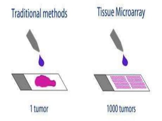 TISSUE MICROARRAY PRESENTATION.pptx