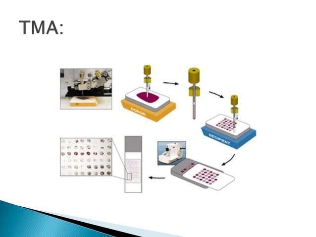 TISSUE MICROARRAY PRESENTATION.pptx | Biological Sciences | Science