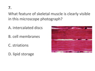 Tissue microscope mini-quiz | PPT