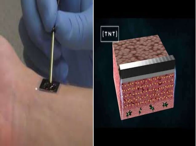 Tissue nano transfection | PPTX | Biological Sciences | Science