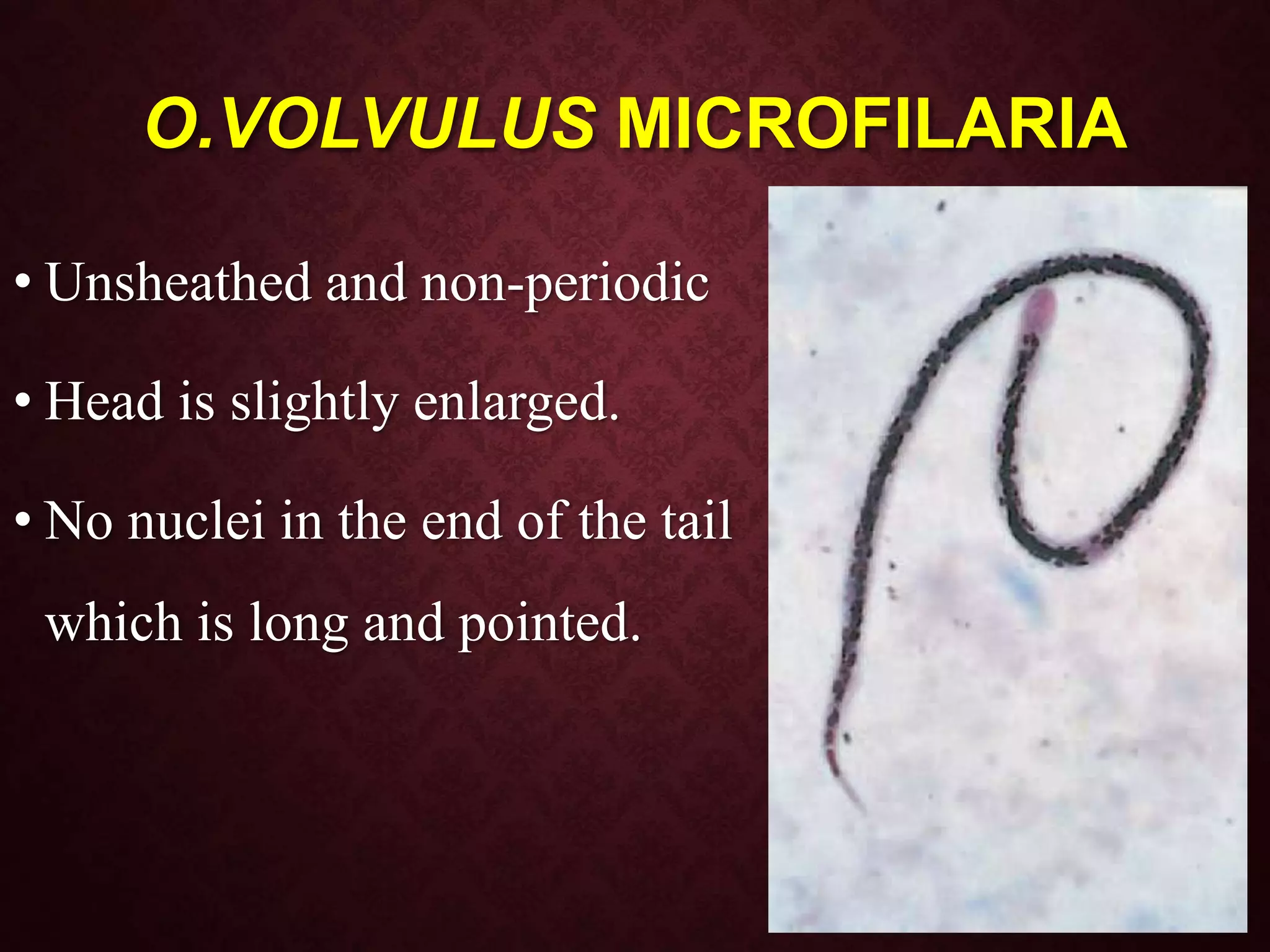 Tissue nematodes | PPSX
