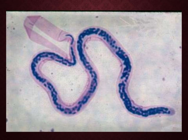 Tissue nematodes | PPSX