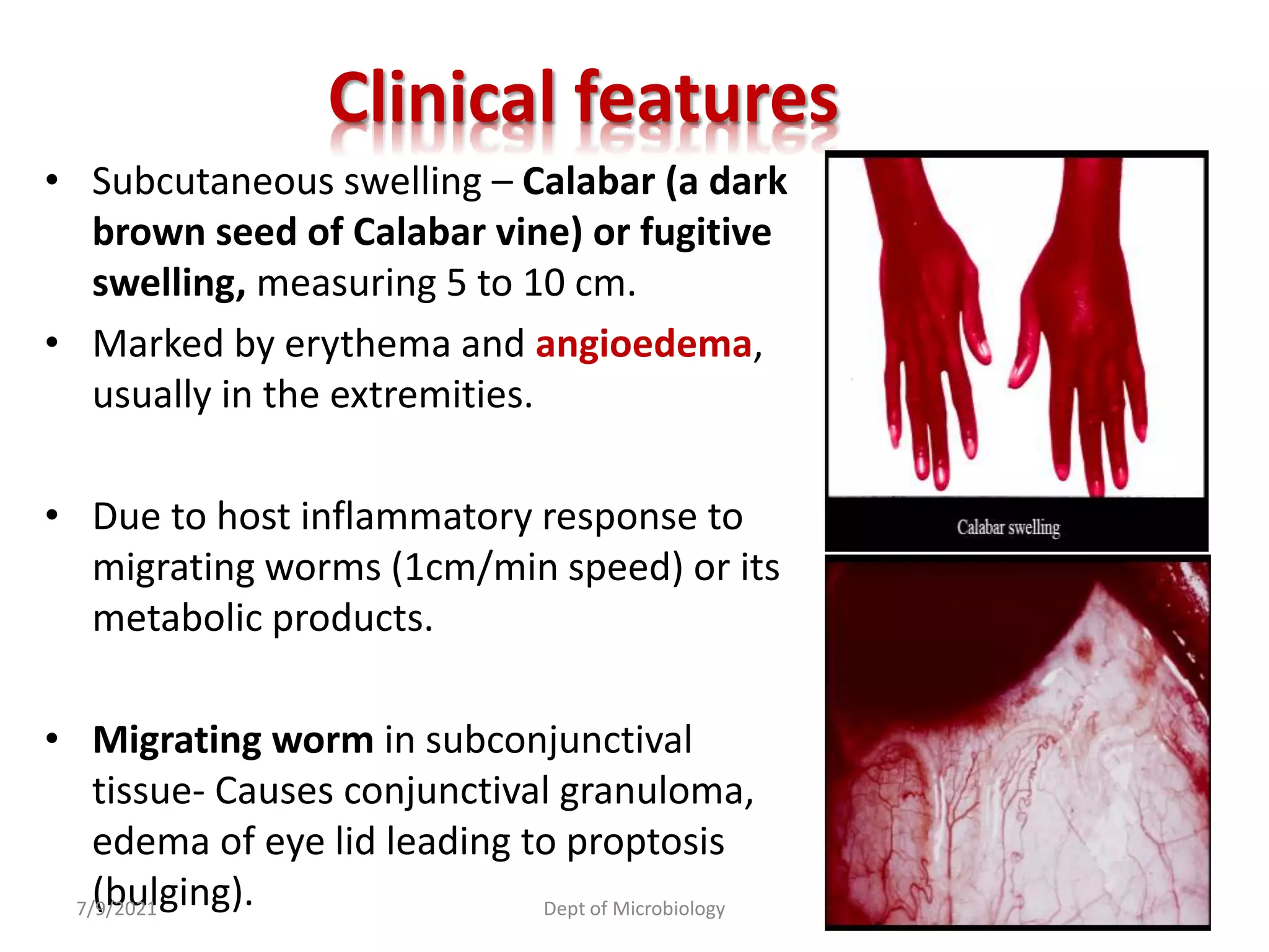 Tissue nematodes | PPTX