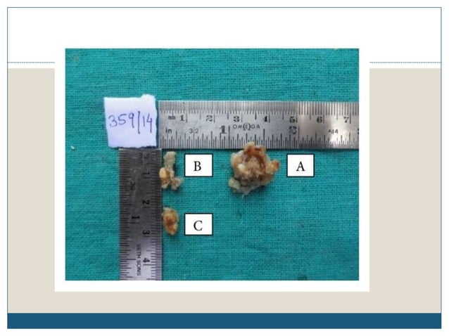 Tissue processing | PPTX