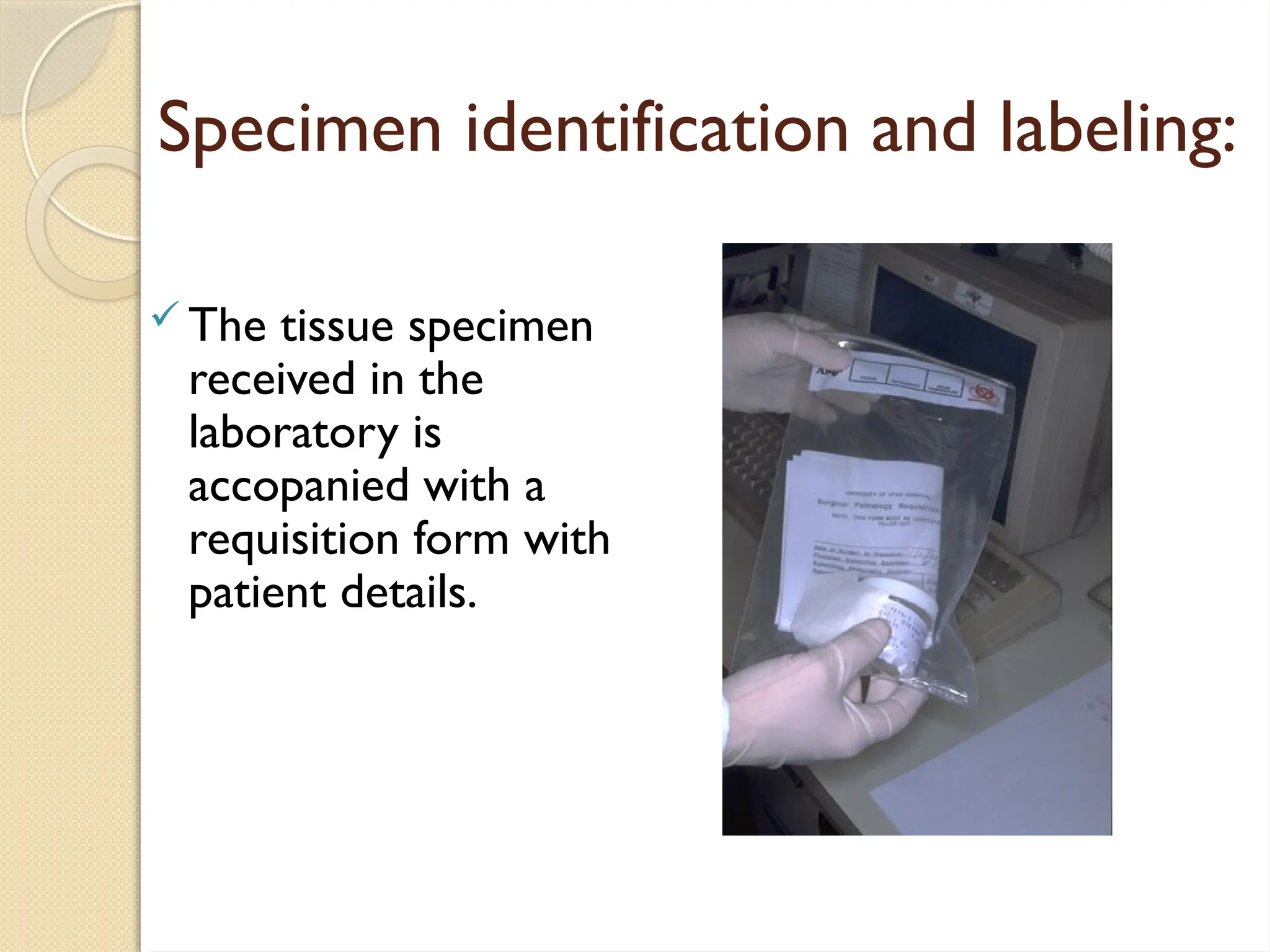 Tissue processing ( HISTOPATHOLOGICAL TECHNIQUE | PPTX