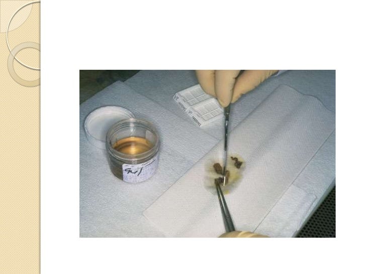 Tissue processing 2012