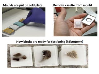 Tissue processing in histopathology -4.pptx