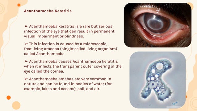 Tissue Protozoa Small group discussion.pdf