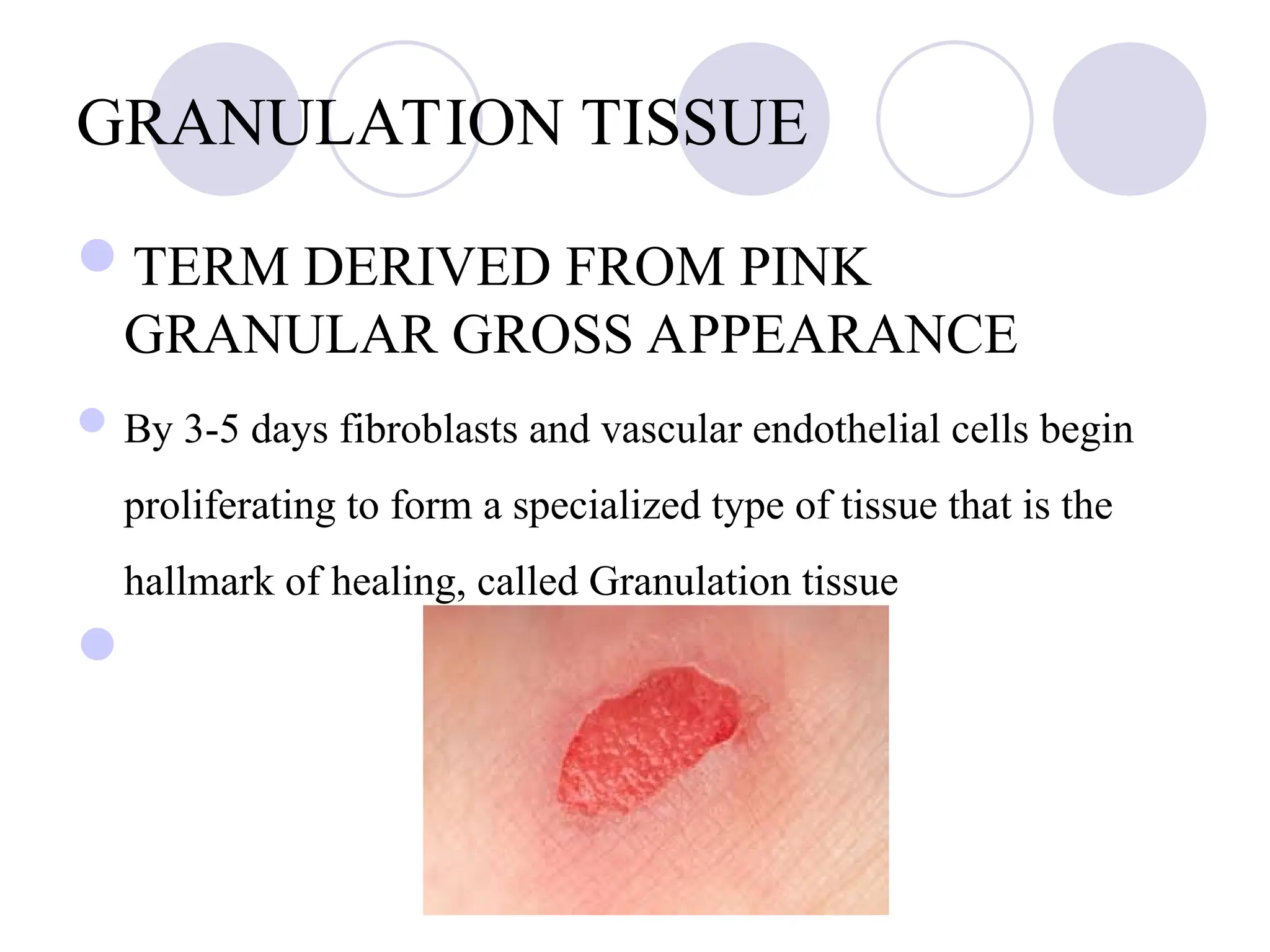 TISSUE RENEWAL AND REPAIR - body’s ability to replace injured.ppt ...