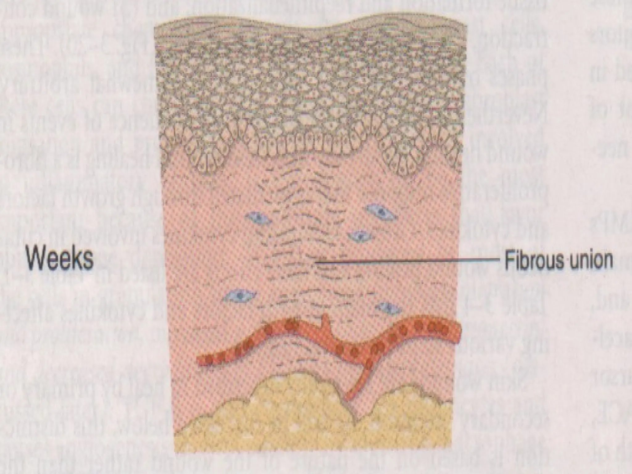 TISSUE RENEWAL AND REPAIR - body’s ability to replace injured.ppt ...