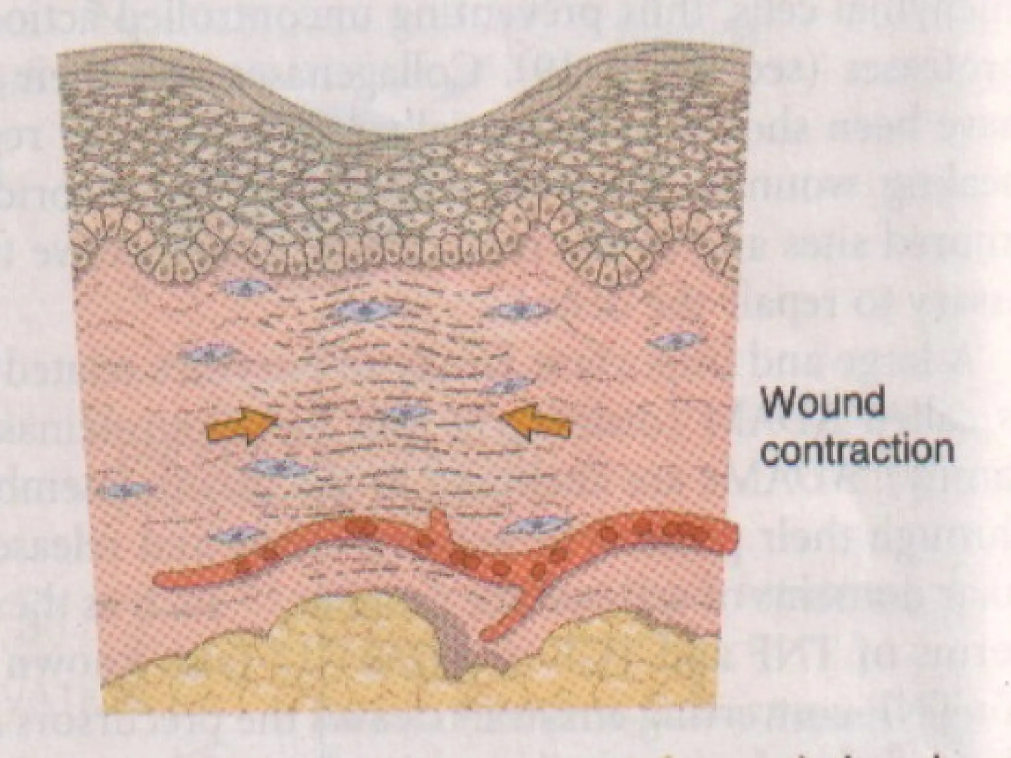 TISSUE RENEWAL AND REPAIR - body’s ability to replace injured.ppt ...