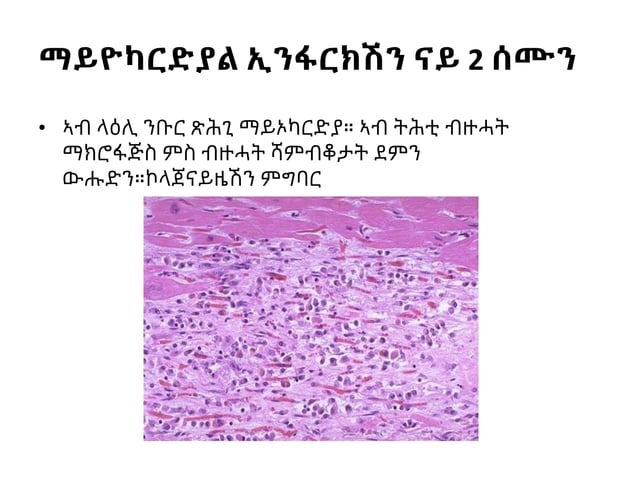 Tissue repair pathology .en.ti g(1).pptx