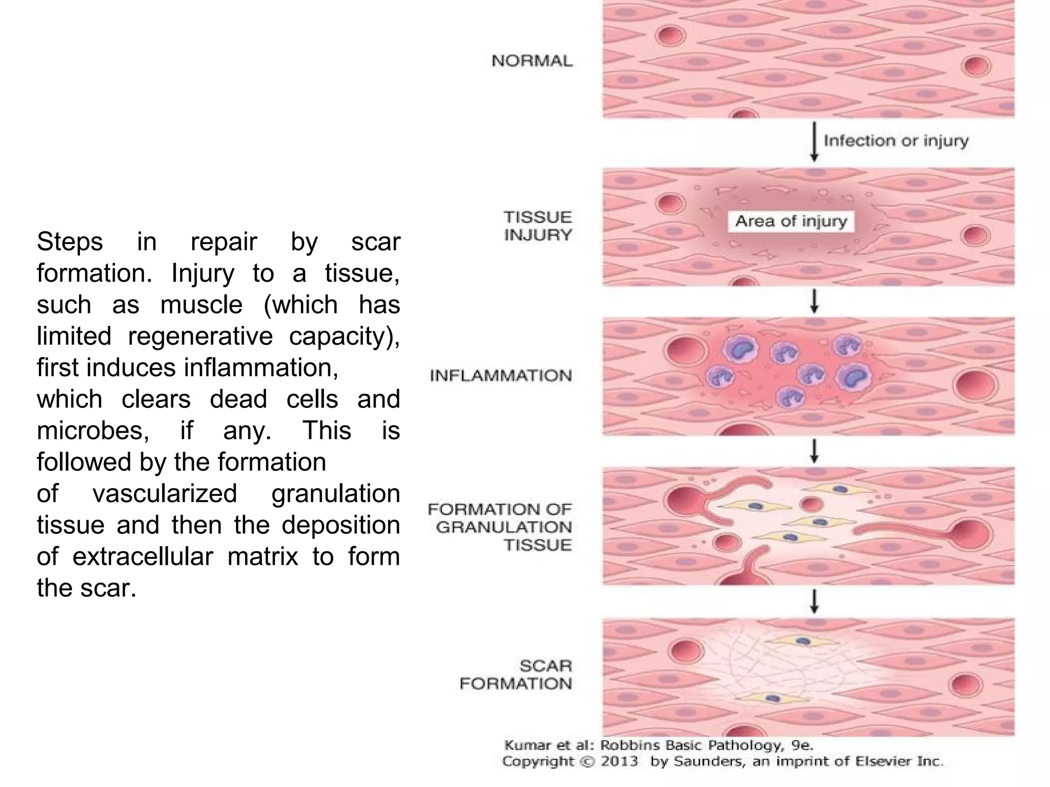 Tissue repair, regeneration and wound healing (1) | PPT