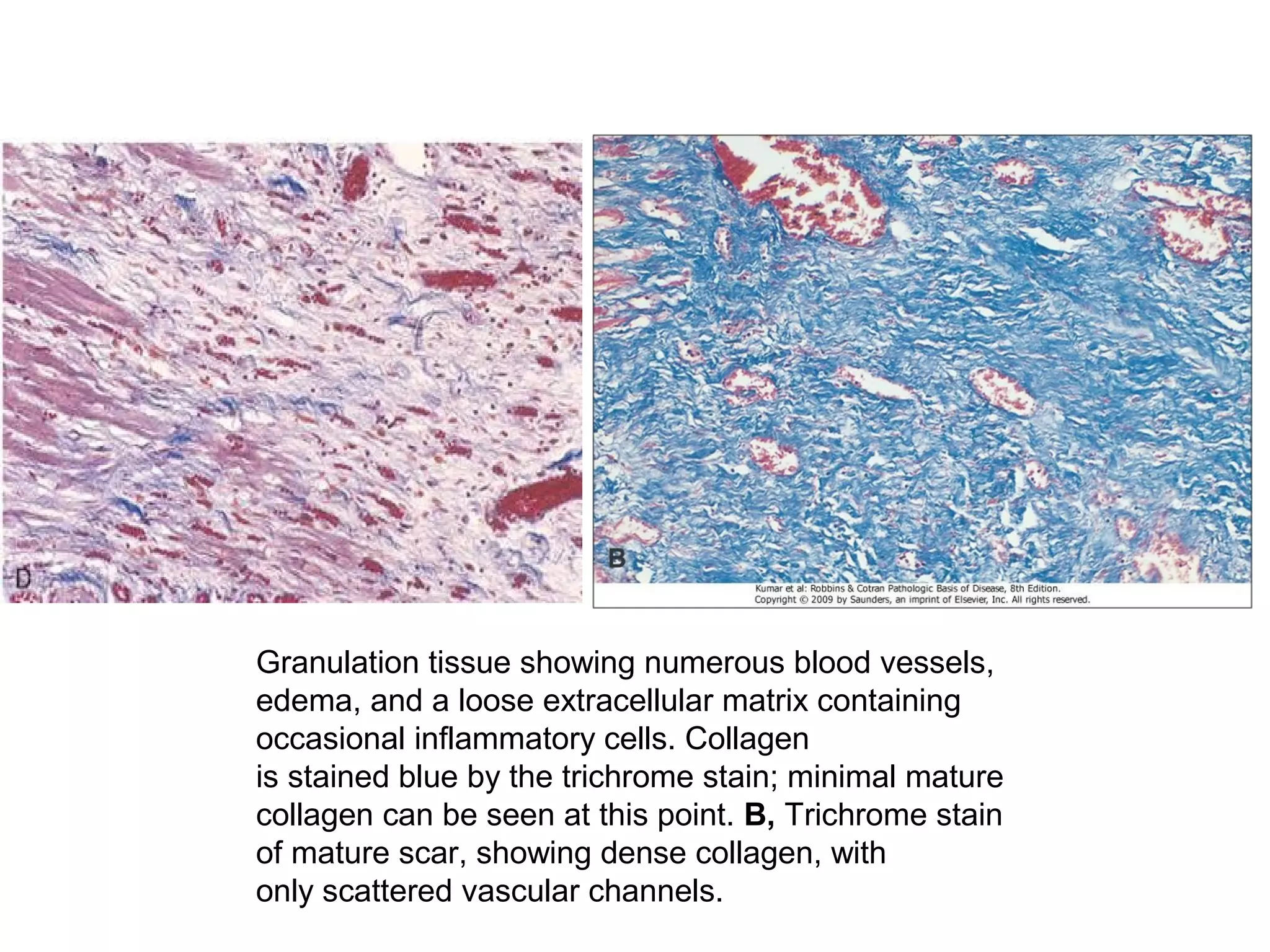 Tissue repair, regeneration and wound healing (1) | PPT