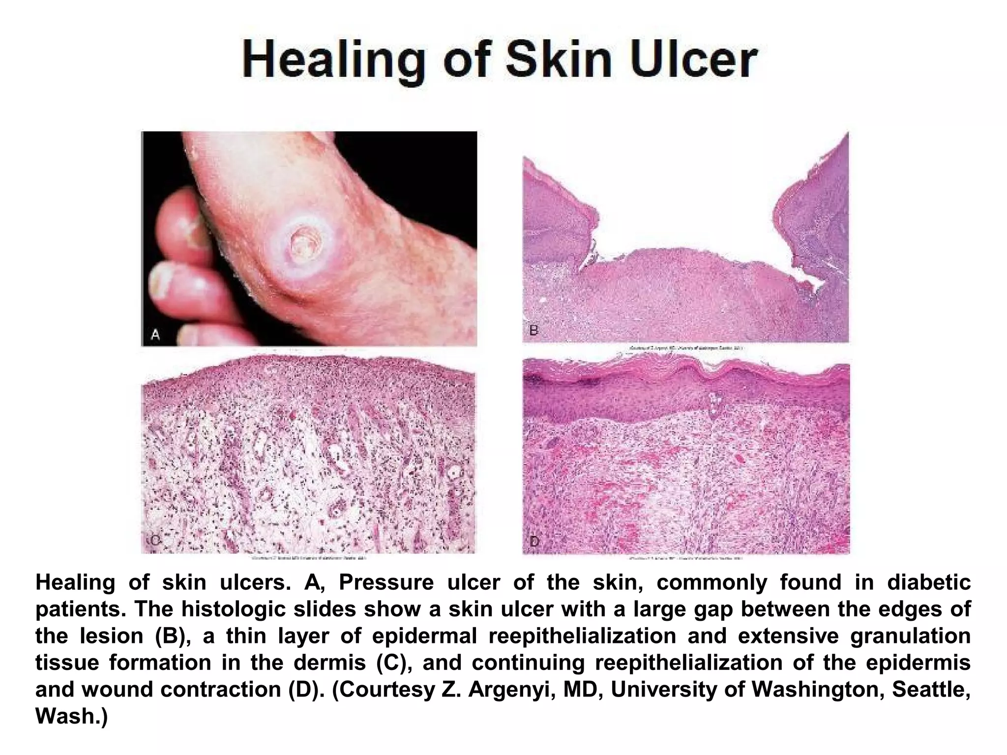 Tissue repair, regeneration and wound healing (1) | PPT