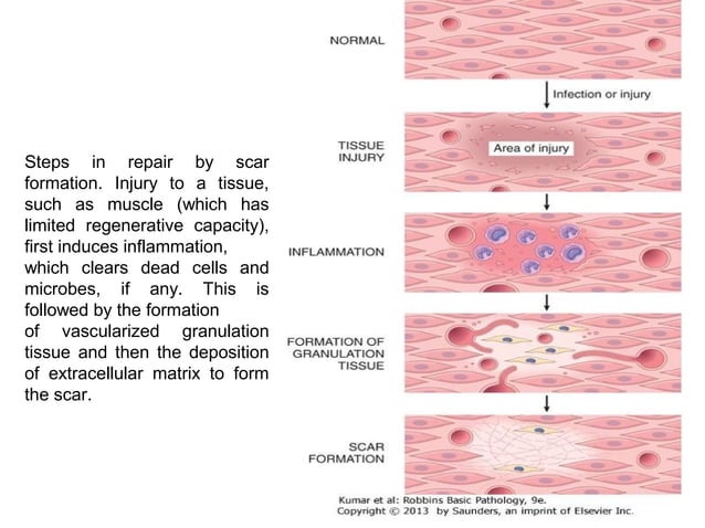Tissue repair, regeneration and wound healing (1) | PPT | Biological ...