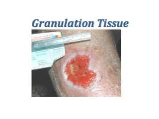 Tissue repair, regeneration and wound healing (1) | PPT