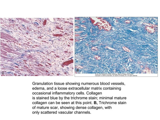 Tissue repair, regeneration and wound healing (1) | PPT | Biological ...