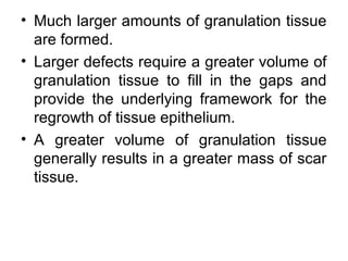 Tissue repair, regeneration and wound healing (1) | PPT